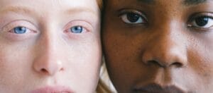 What is a Fitzpatrick Scale and Why is it Important? – Resurgence Wellness